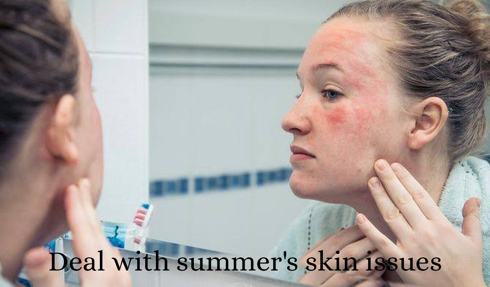 Deal With Summer Skin Problems – Asraderm